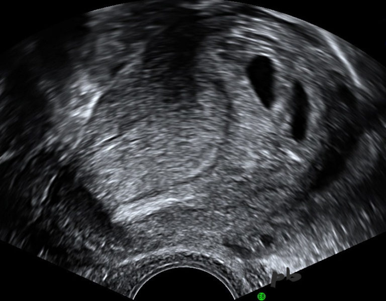 GEU – Page 3 – CGLRE