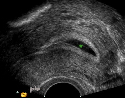 GEU – Page 1 – CGLRE
