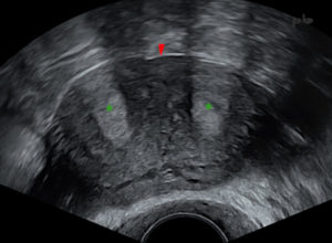 Malformations – Page 1 – CGLRE