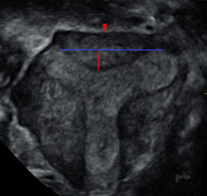 Malformations – Page 1 – CGLRE